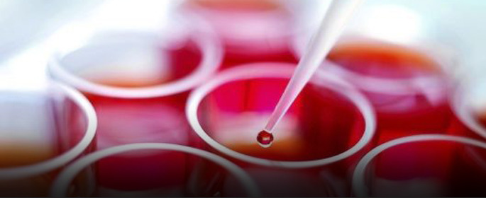 Human Serum Samples for Research and Drug Discovery Uses - Bay Biosciences