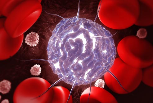 Cutaneous B-Cell Lymphoma Samples for Research - Bay Biosciences