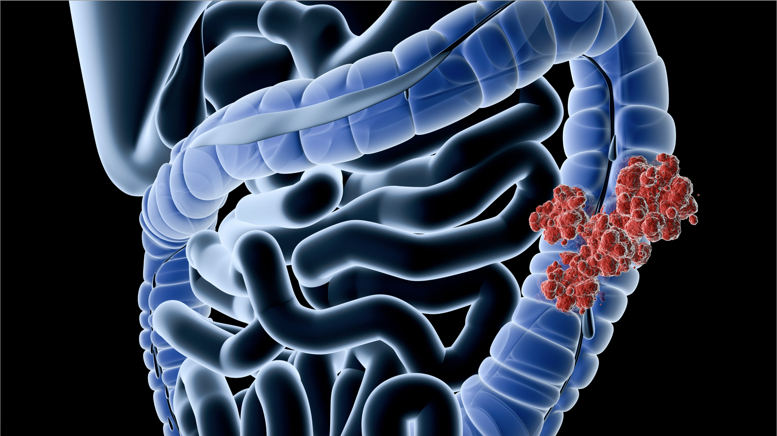 Lynch Syndrome-HNPCC Samples - Bay Biosciences, LLC.