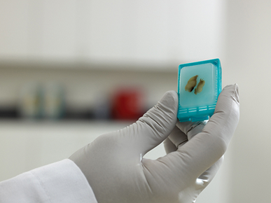 Human Tissue Samples for Biomedical & Clinical Research