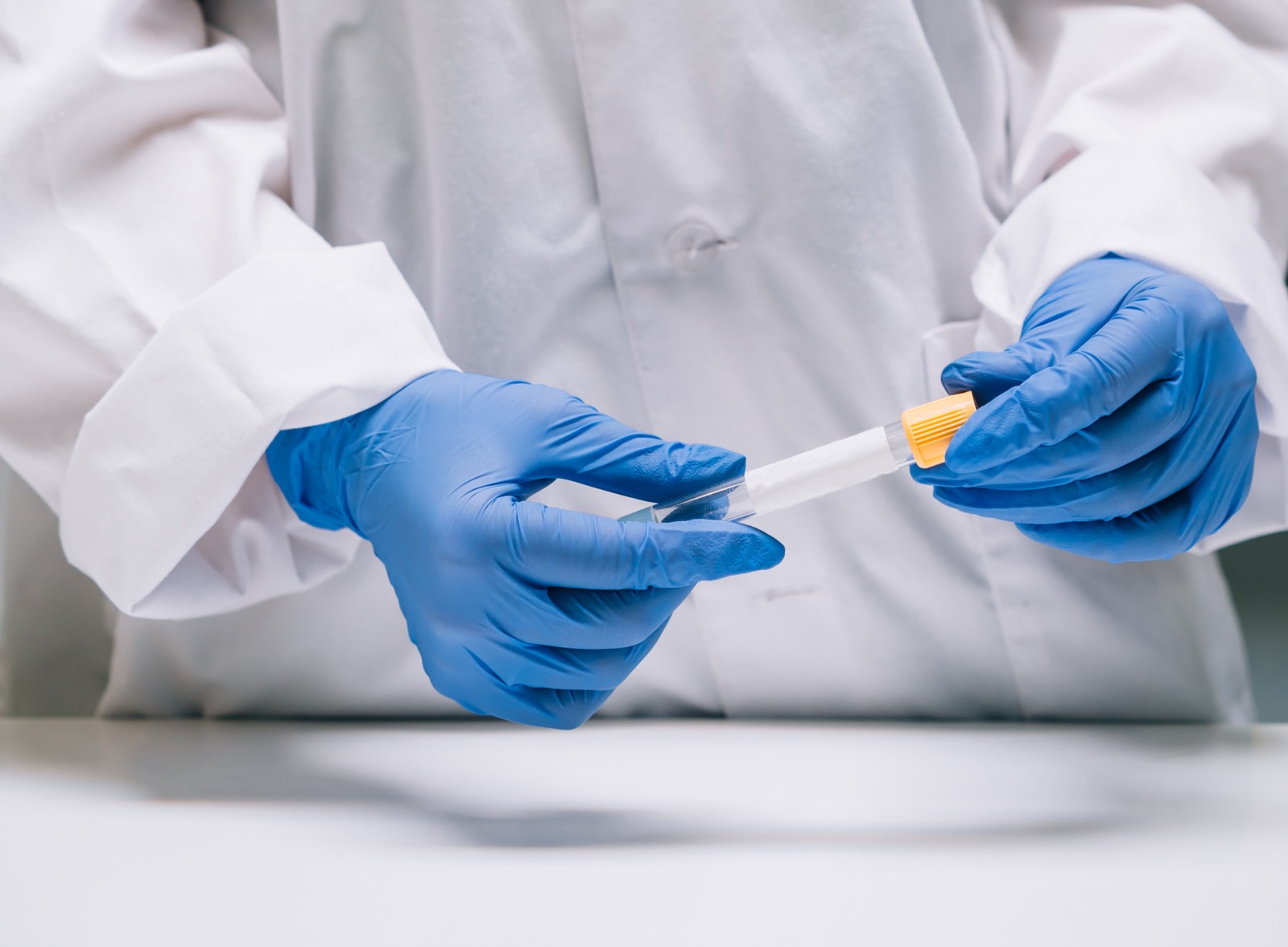 Inflammatory Disease Samples for Research